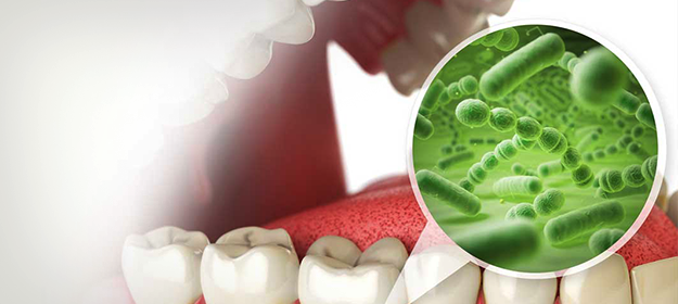 Mujeres con infección crónica de encías con mayor riesgo de padecer ...