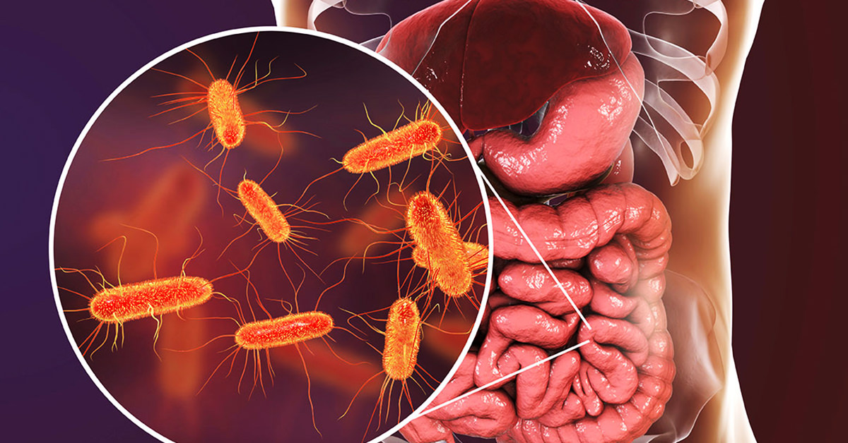 Diferencias en las bacterias intestinales pueden distinguir la ...